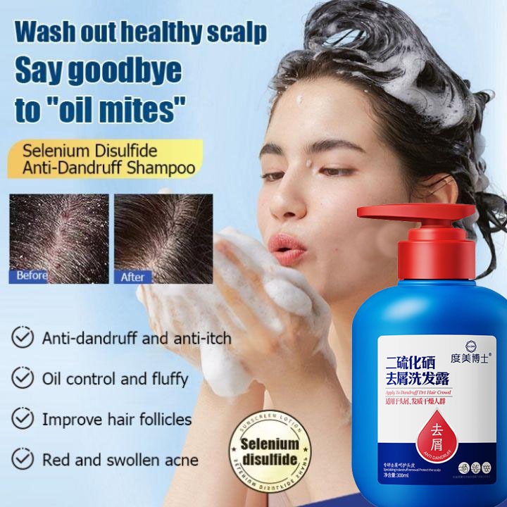 Selenium Disulfide Anti dandruff and Antipruritic Shampoo for Treating ...