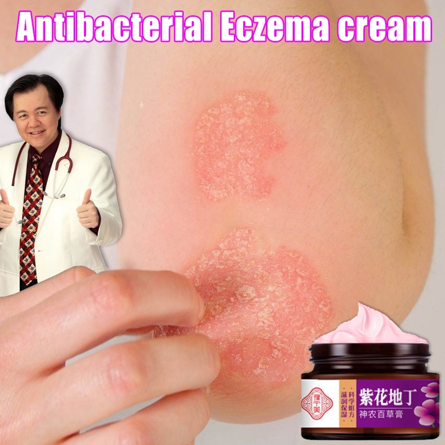 Psoriasis Antibacterial Cream ubat gatal Dermatitis Eczematoid Ointment Effective Anti-Itch ...
