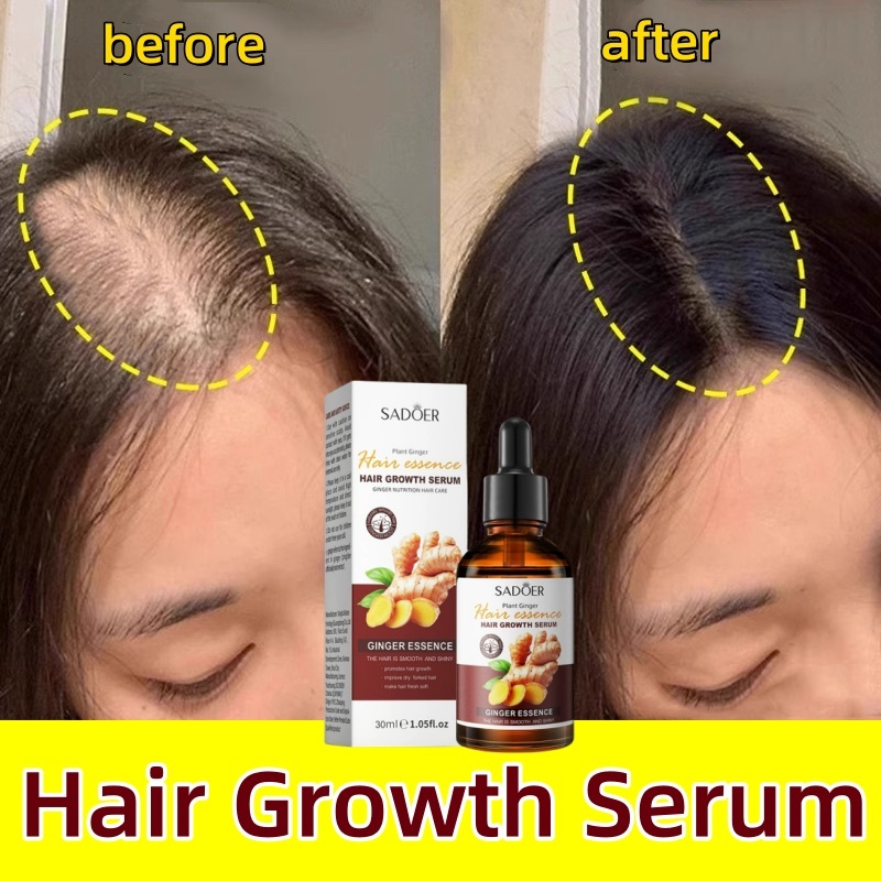 Hair growth serum Lebatkan rambut Serum rambut gugur Hair Grower Fast ...