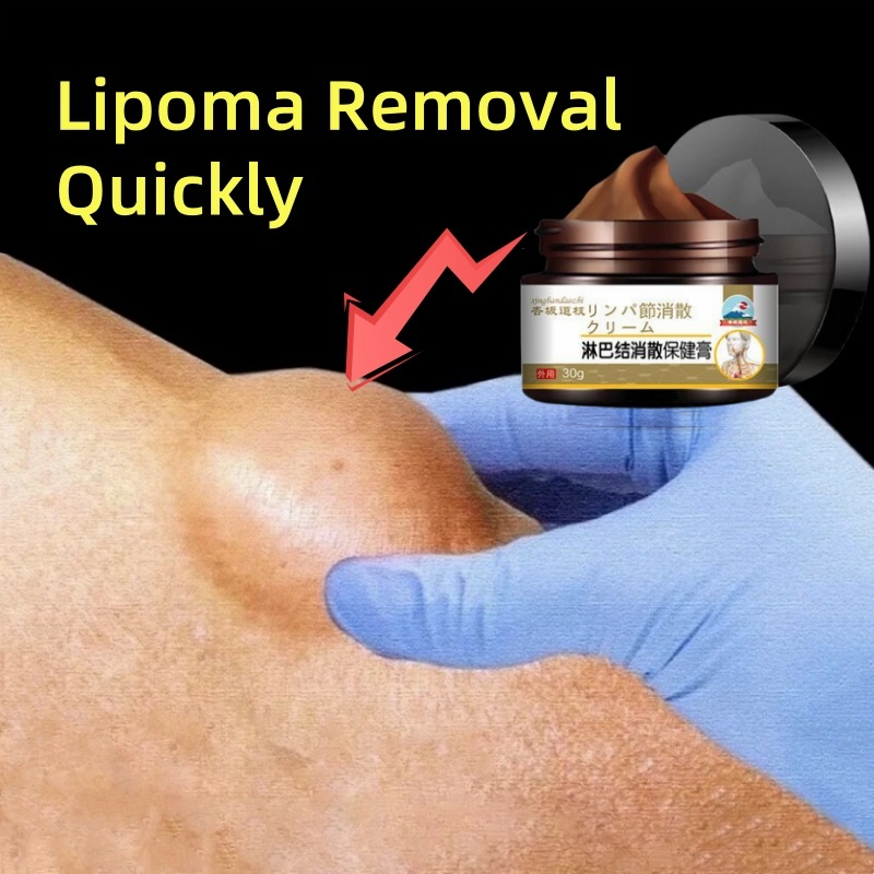 Lipoma cream Ubat benjolan Lymphatic drainage Lymph Care Herbal Essence ...