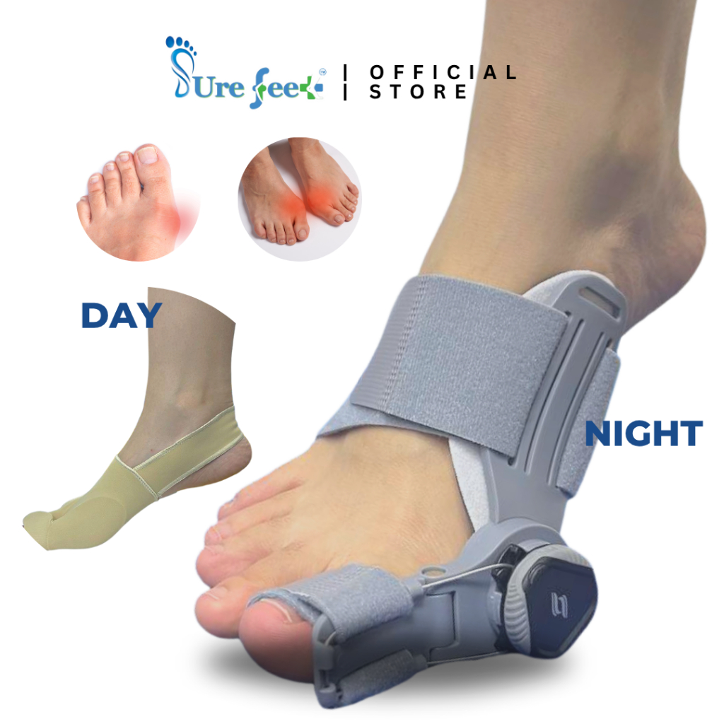 SURE FEET Toe Corrector Orthotics for Hallux Valgus | Adjustable Bunion ...