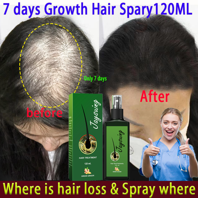 Jaysuing hair growth Spray Rambut Gugur hair growth tonic Hair Growth ...