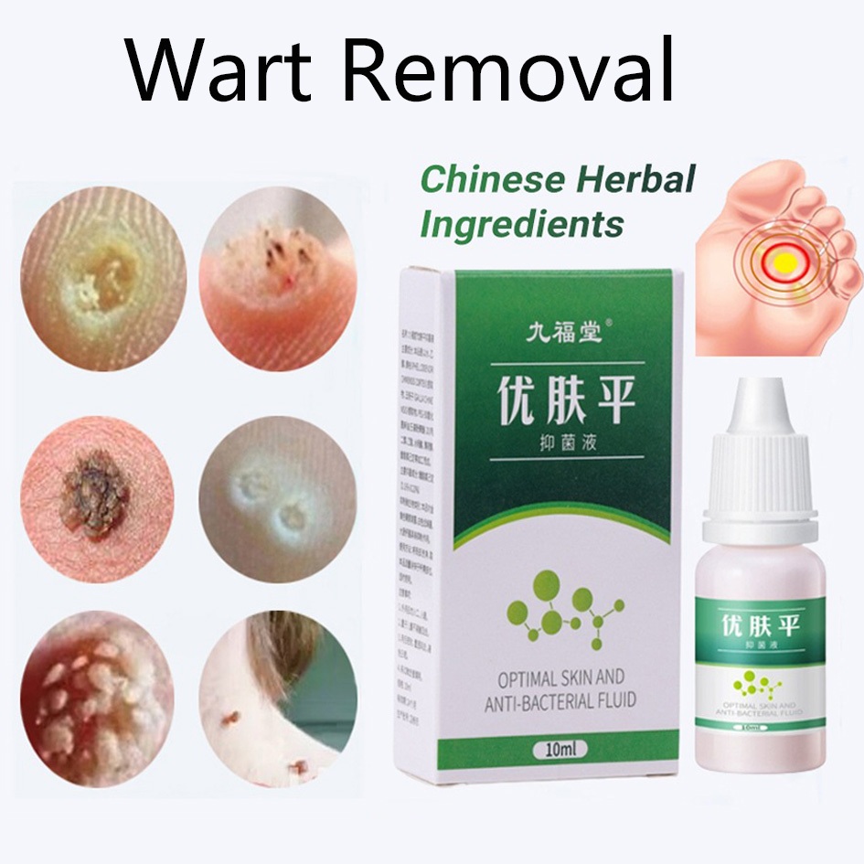 Ubat Ketuat Warts Removal Cream Ubat Kutil 10ml Quick Removal Of Warts ...