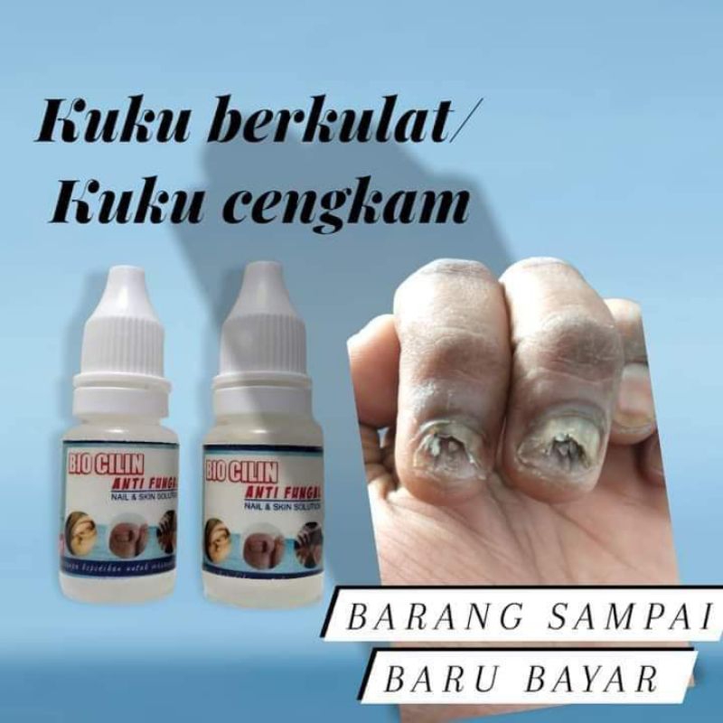 BIOCILIN ANTI-FUNGAL | Shopee Malaysia