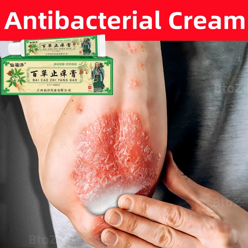 krim gatal kulit eczema cream psoriasis cream Herbal antibacterial Anti itch Relief Eczema Cream ...