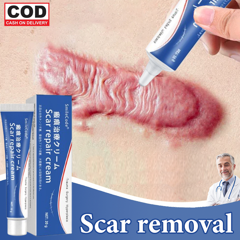 Scar removal cream Remove Stretch Marks Scald Burns Bite Scar Ubat Krim ...