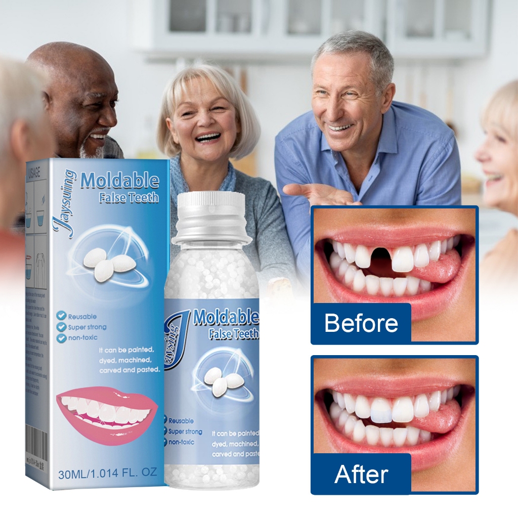 Resin Tooth Repair Glue Shapeable Teeth Gaps Filling Solid Glue ...