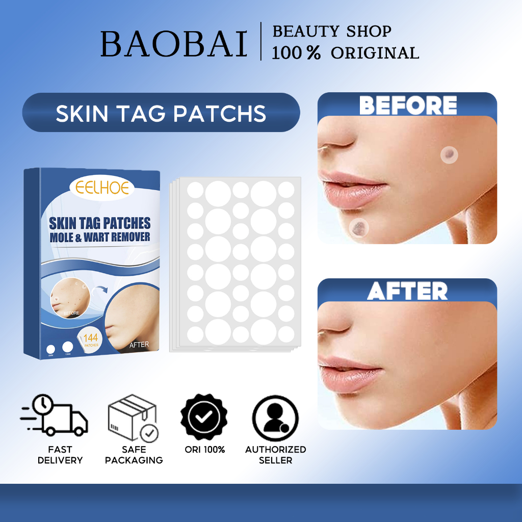 EELHOE Skin Tag Patches 144pcs Mole&Wart Remover Ubat Kutil Ketuat ...