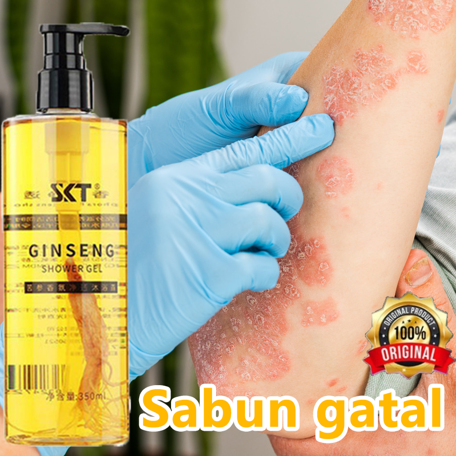 Eczema Body Wash sabun gatal kulit paling berkesan Psoriasis Antifungal ...