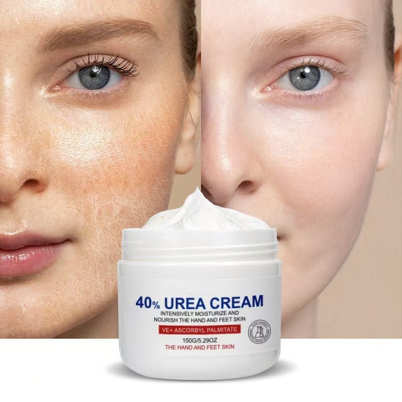 150g Foot Urea Cream/40% Urea Cream /for Dry Cracked Rough Skn Repair ...