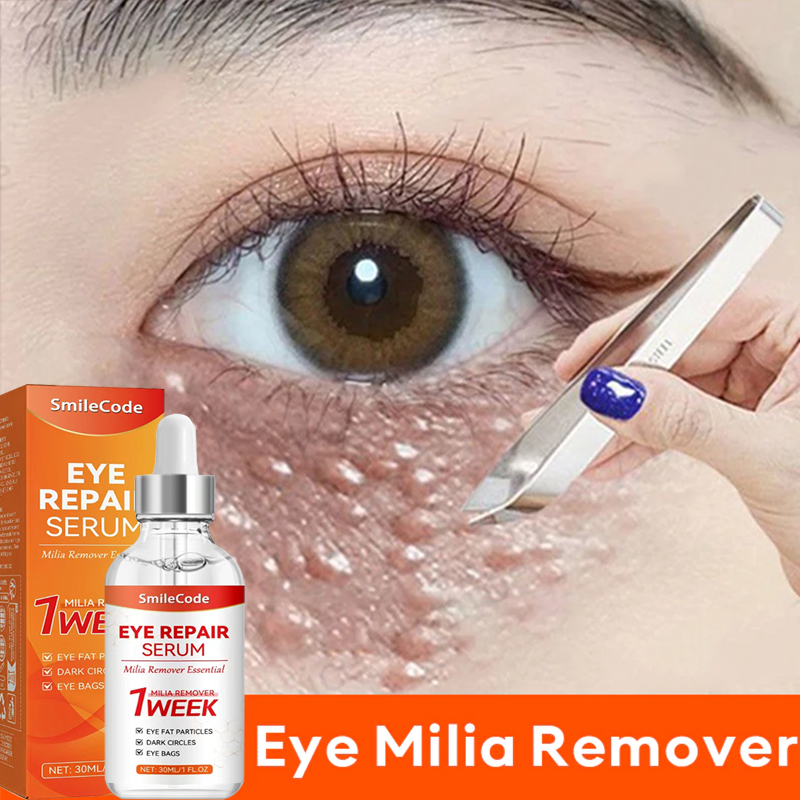 Milia Seed Remover Fat Granule Syringoma Milia Remover Grease Grains ...