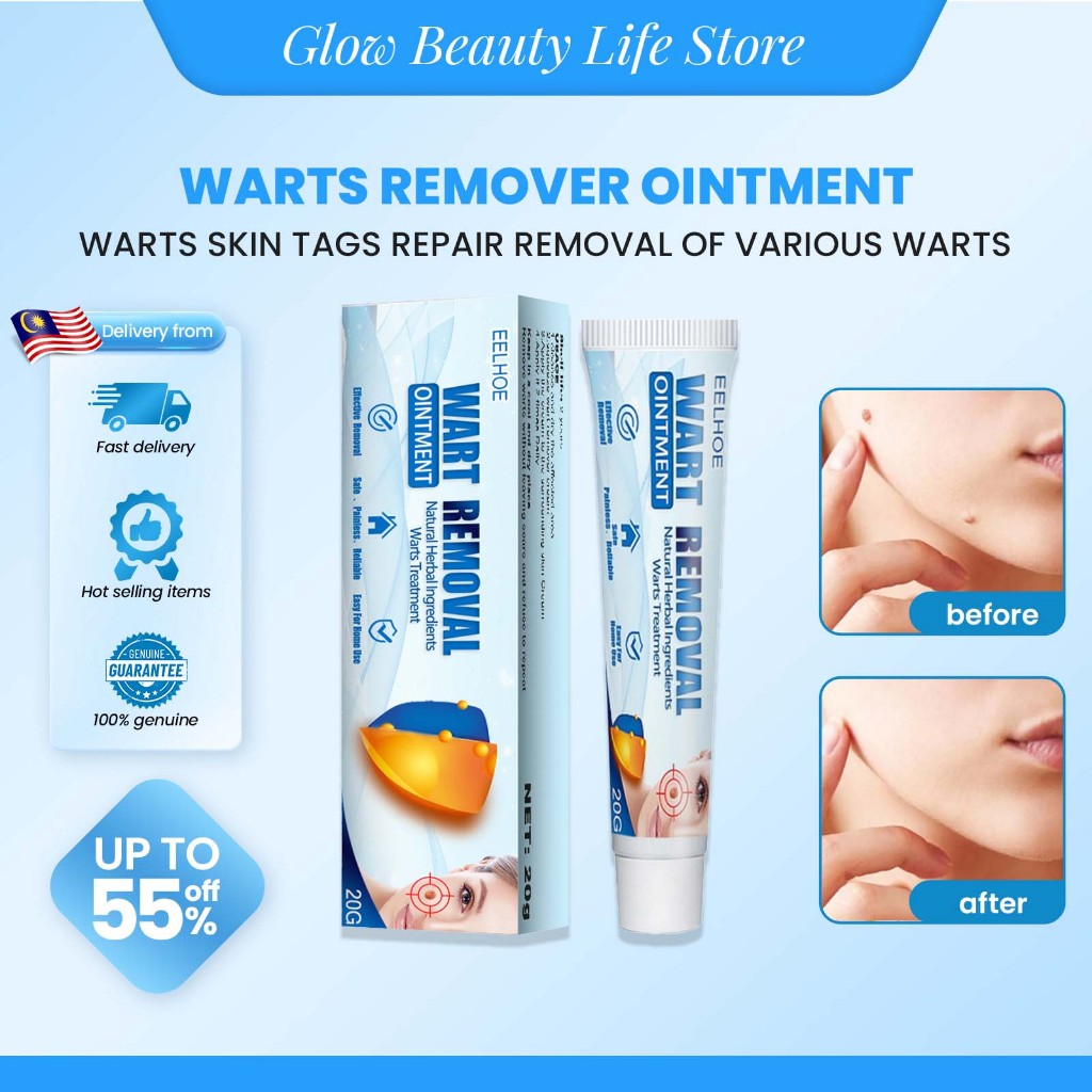【🔥HOT SALE】Warts Remover Ointment Ubat Buang Kutil Ubat Buang Ketuat ...