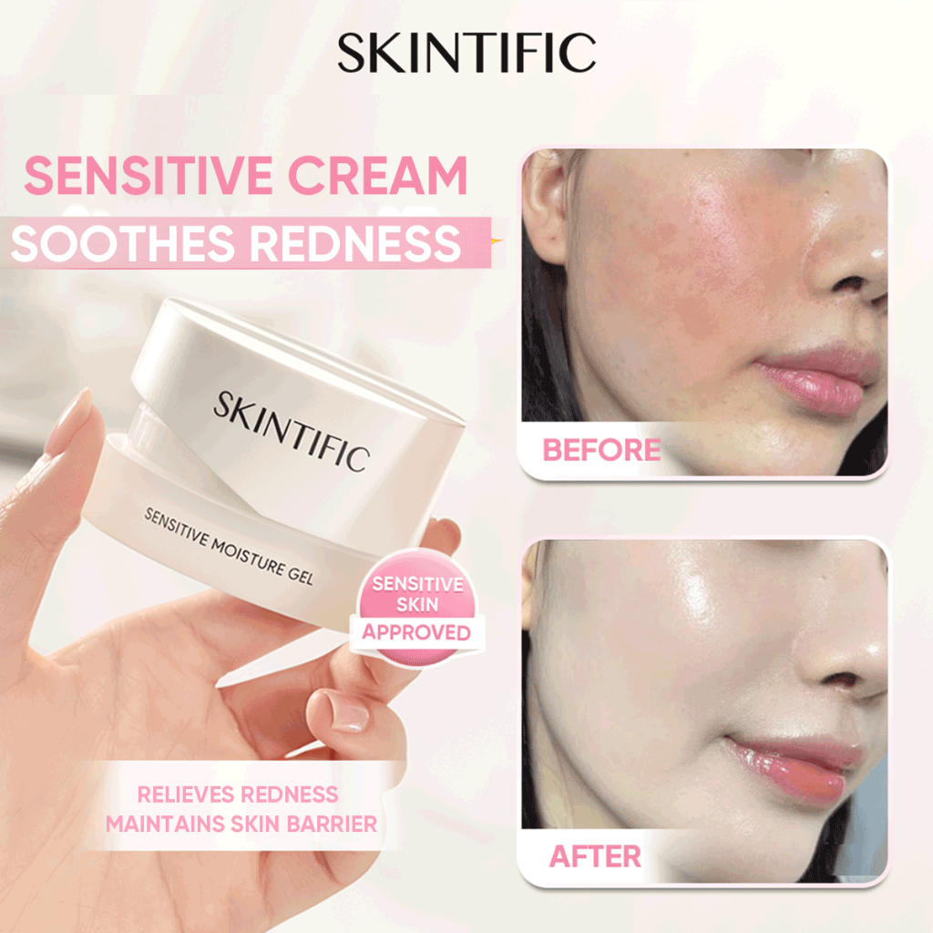 SKINTIFIC Sensitive Series Moisturizer Gel 40ml Soothe & Repair Reduce ...