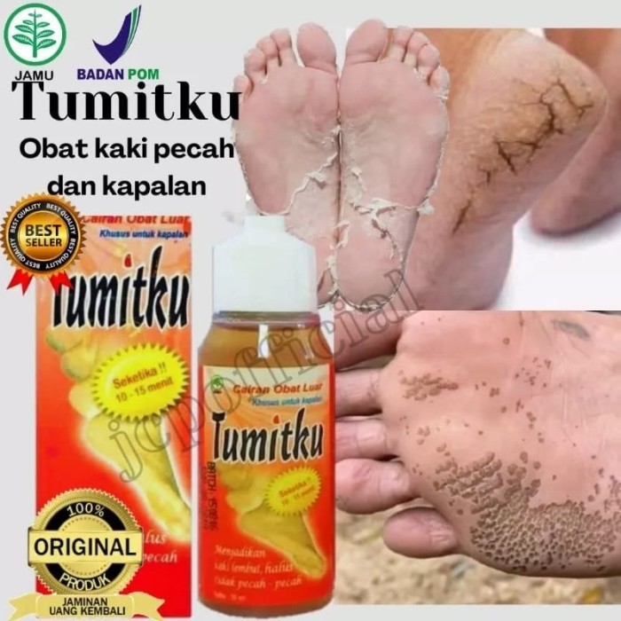 TUMITKU OBAT HERBAL UNTUK KAKI PECAH DAN KERING READY STOCK TERBAIK ...