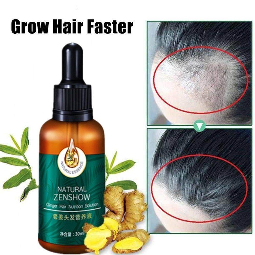 Ginger King Hair Growth Serum Tumbuh Rambut rambut gugur ginger hair ...
