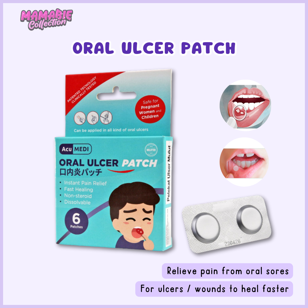 Ulcer Patch ubat ulser mulut Pelekat Ulcer Mouth Oral ulser patch for treatment | Shopee Malaysia