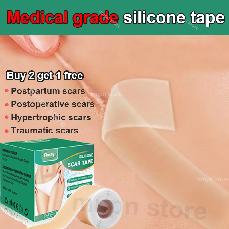 silicone scar tape keloid scar remover scar patch silicone scar sheet ...