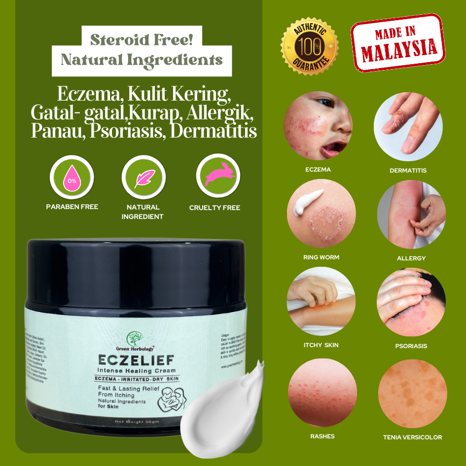 Natural Eczema Product - Ekzema, Gatal Kulit I Eczema Cream I Lotion I ...