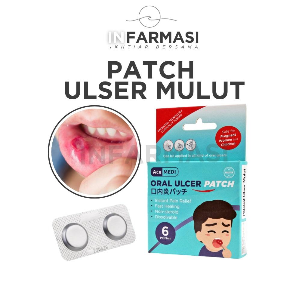 AcuMedi Oral Ulcer Patch - 2's (Strip) & 6's (Box) | Ubat Sakit Ulser ...
