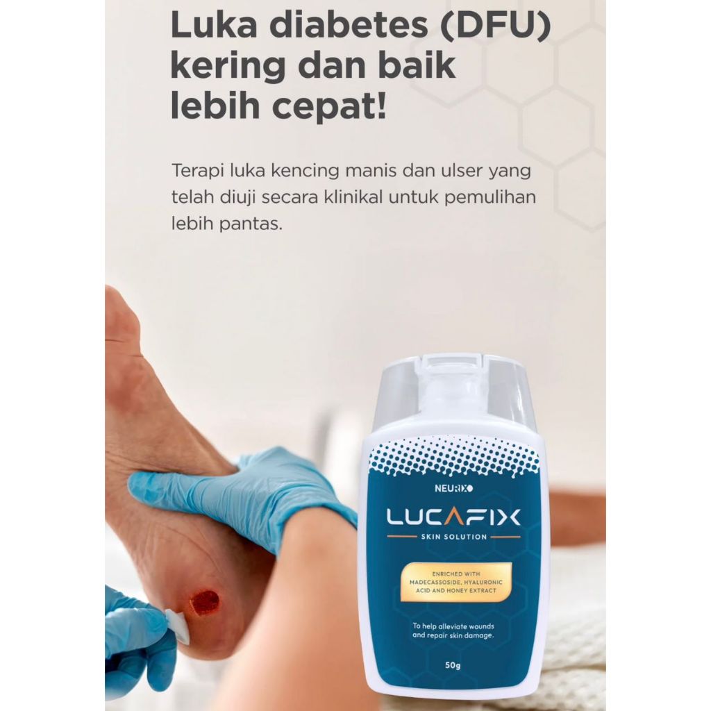 Lucafix - Skin Solution | Luka eczema | Gatal dan Kebas2 | Luka Ulser ...