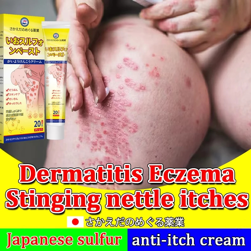 Psoriasis Cream Antifungal cream Eczema cream Cream gatal kulit 20g Japan Sulfur anti itch cream ...