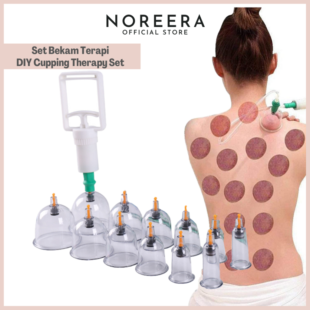 Alat Bekam Massage Detox Therapy Devices DIY Cupping Set Pain Relieve ...
