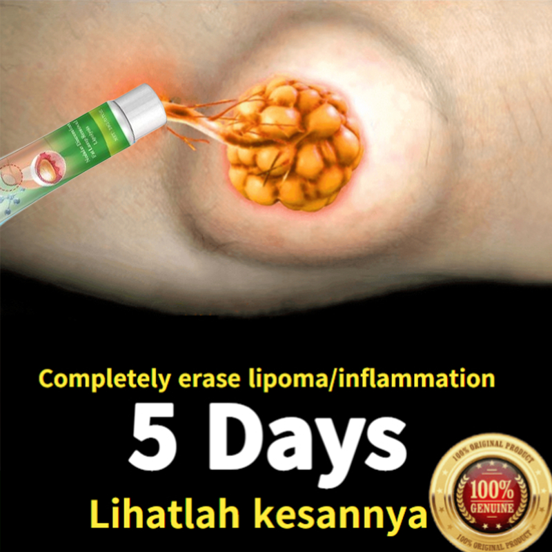Lipoma Removal Cream original 20g Lipolysis Fat Lump Relief Plaster ...