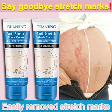 Anti Stretch Mark Cream Maternity Skin Repair Remove Pregnancy Scars ...