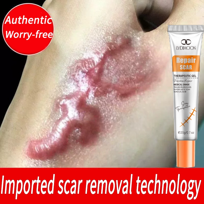 LYDIMOON Scar removal cream Gel stretch mark cream acne scar treatment ...