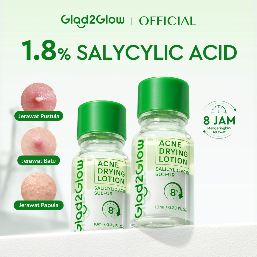 Glad2Glow Acne Drying Lotion 10 ml Calms Acne Treament Scar Pimple Acne ...