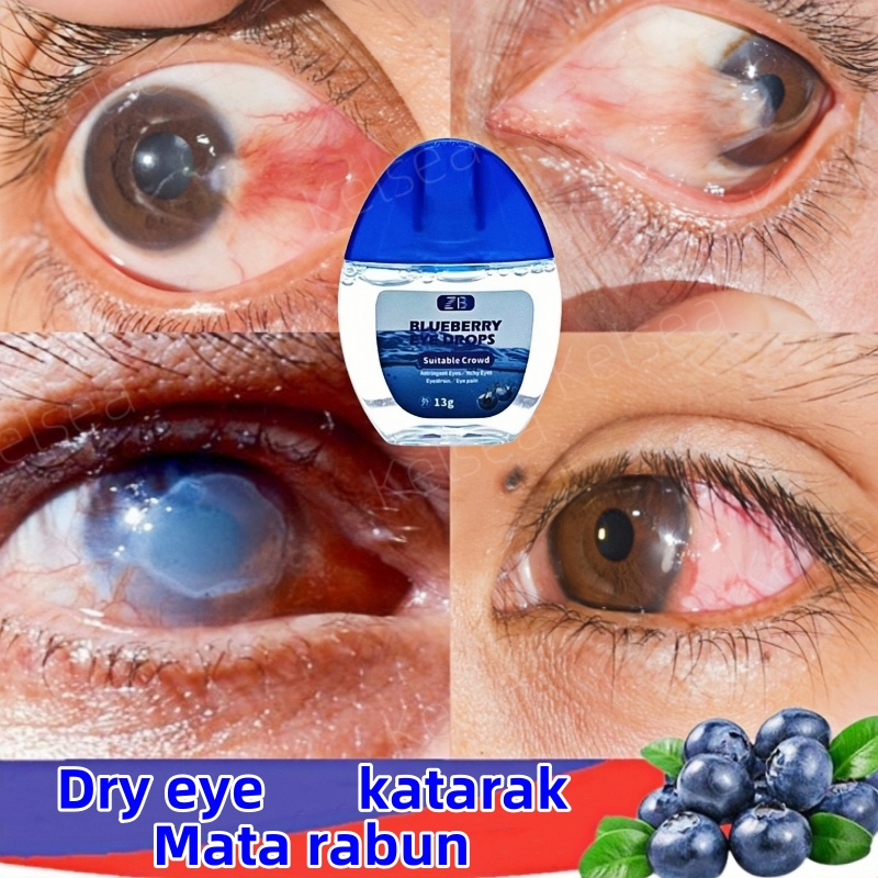 Blueberry Eye Drops Obat mata katarak Eye drops for dry eye rawatan Mata selaput Mata rabun Mata ...