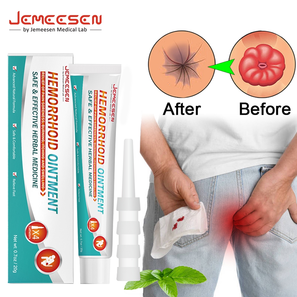 Jemeesen Hemorrhoid Cream Ubat Buasir 100% Berkesan Herba Cina Krim Buasir Relieve Pain, Itching ...