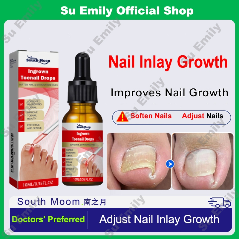 ubat kuku rosak ingrown toenail nail fungus treatment ubat kuku cekam ...
