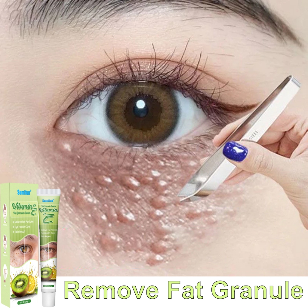 milia seed remover vitamin E Krim at Particles Fat Granule dark circle ...