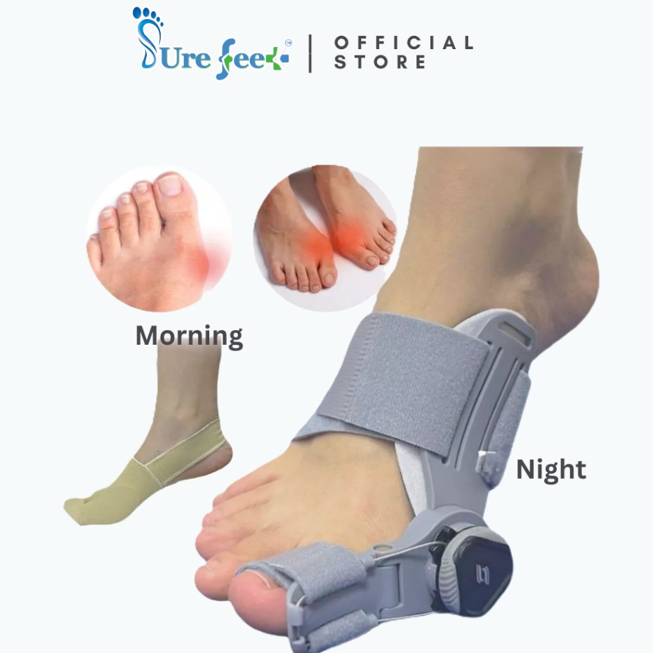 SURE FEET Toe Corrector Orthotics for Hallux Valgus | Adjustable Bunion ...