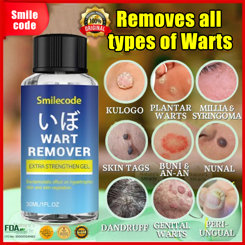 Wart Remover Serum Skin Tag Remover Mole Remover Ubat Ketuat Kutil ...