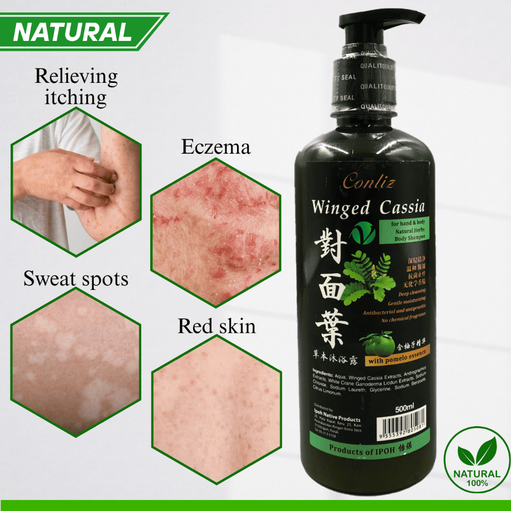Winged Cassia Body Shampoo 500ml |Anti-itch | Ringworm| Sweat spots ...