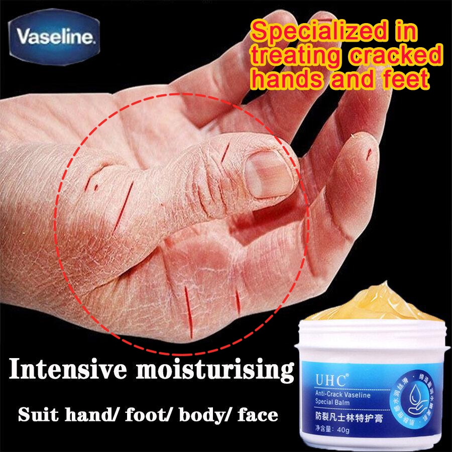 Vaseline Moisturizing Cream Hand Cream Heel Crack Hand Foot Repair Anti ...