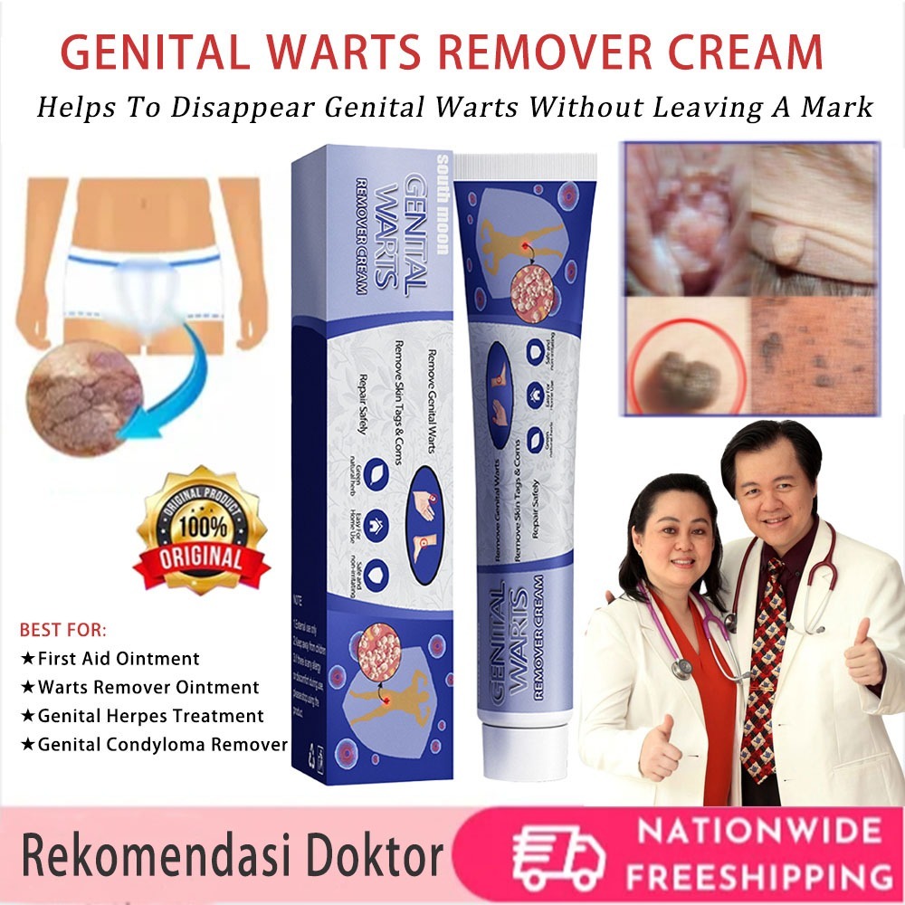 Ubat buang kutil ketuat tahi lalat biji kolestrol Mole Removal Wart ...