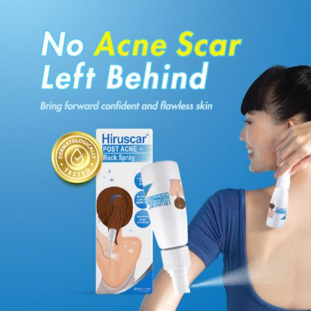 Hiruscar Post Acne Back Spray 50mL | Shopee Malaysia