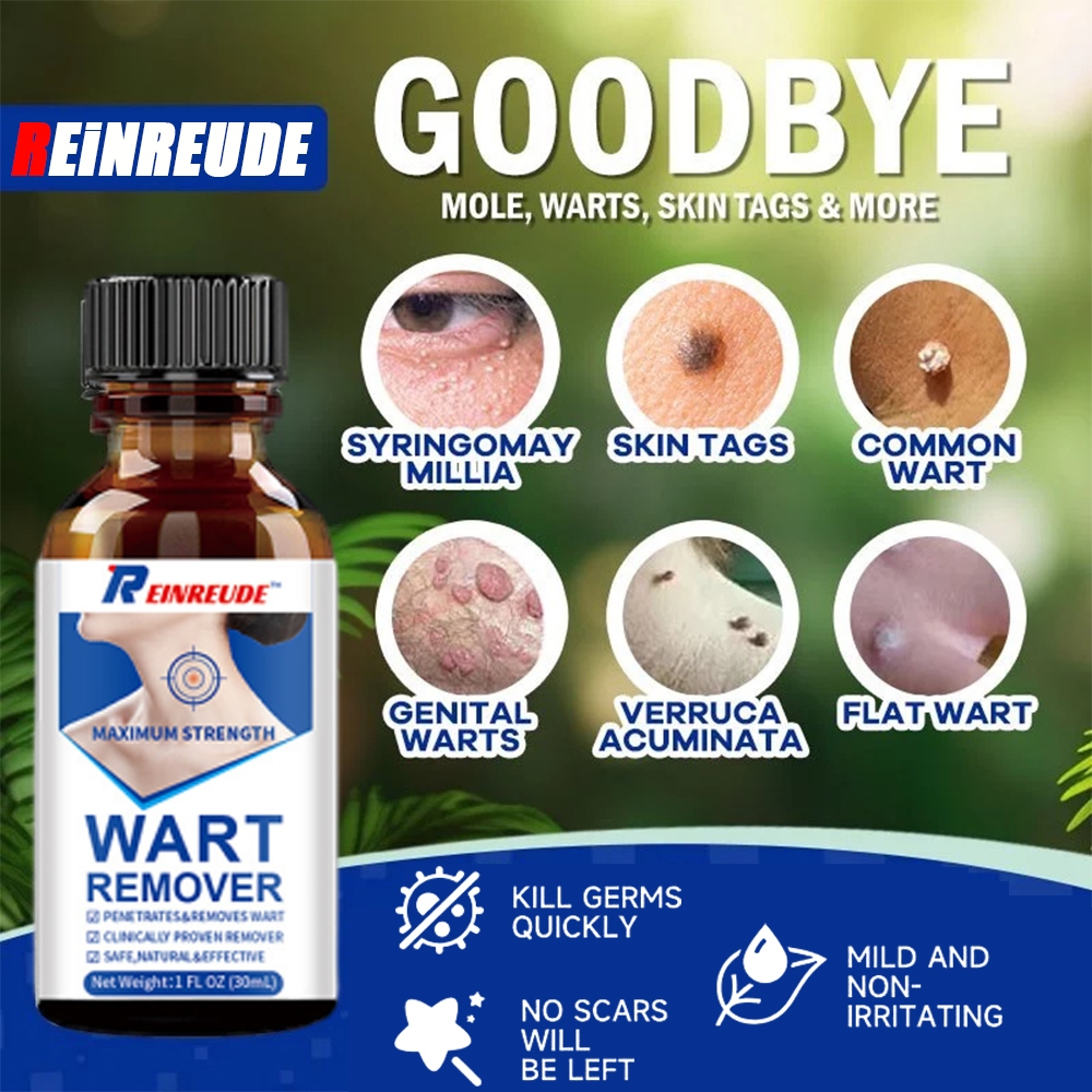 Wart Remover Serum Skin Tag Remover Mole Remover Ubat Ketuat Buang tahi ...