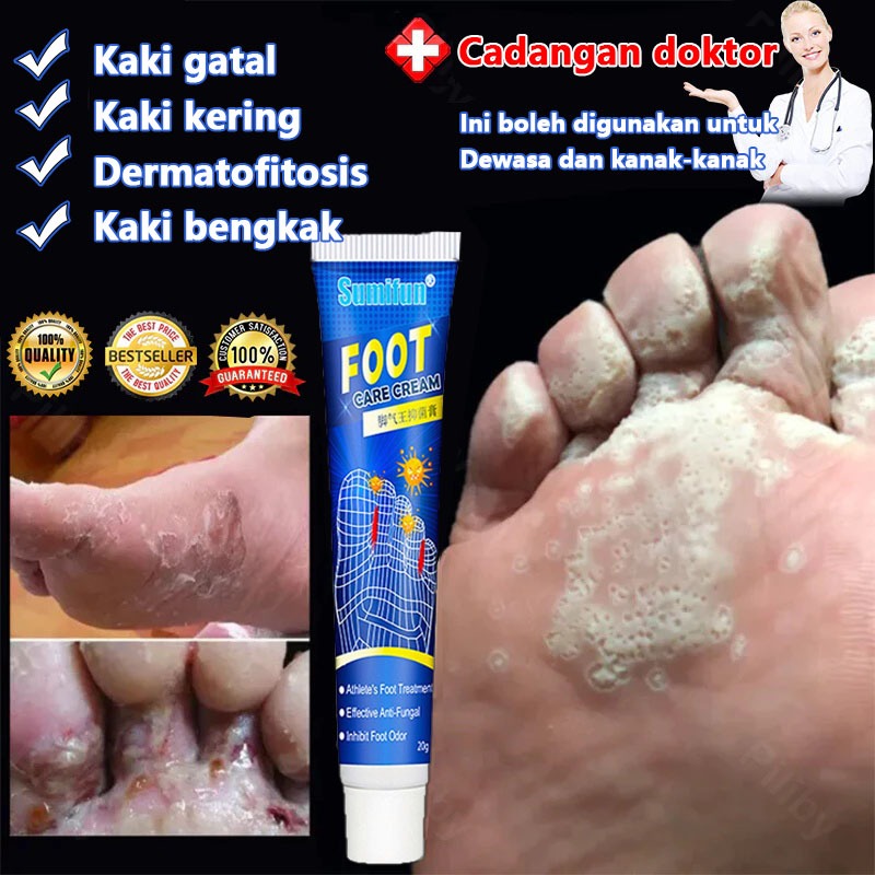 ubat kulat air kaki ubat kaki berbau Kaki mengelupas Foot fungus ...