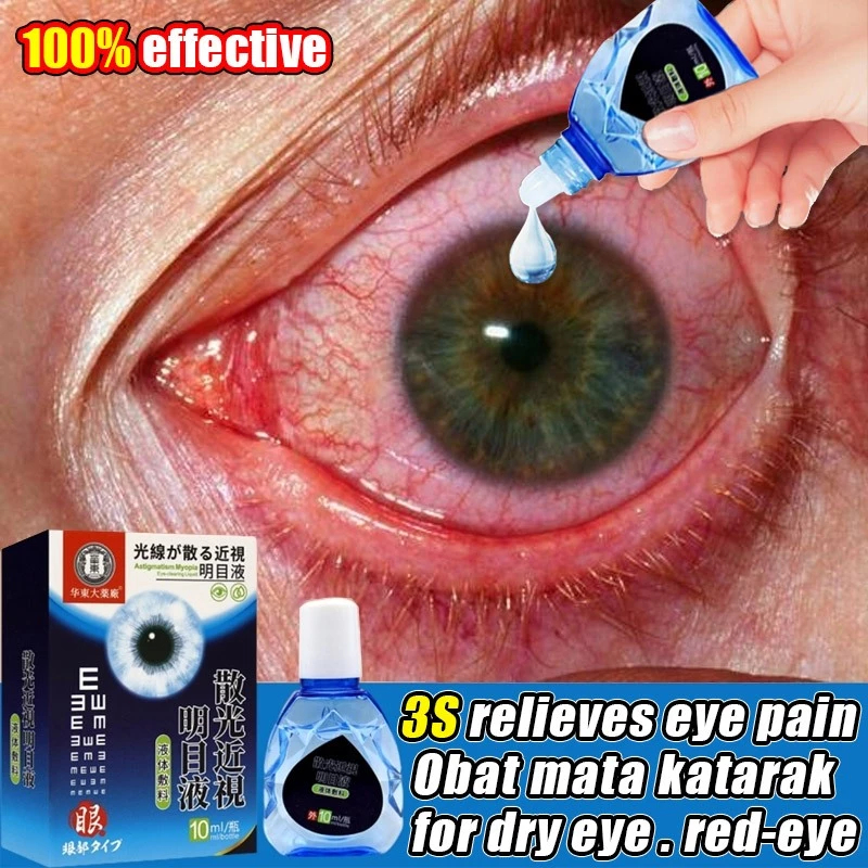 Original Eye Drops For Dry Eye Myopia Astigmatism Improvement Ubat Mata ...