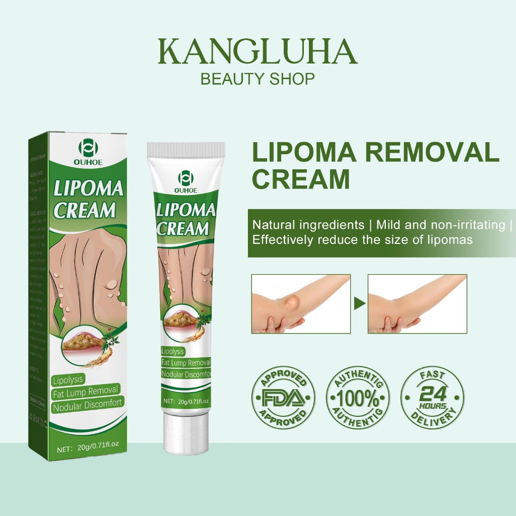OUHOE Lipoma Removal Cream 20g Anti Swelling Ointment Treatment Skin ...