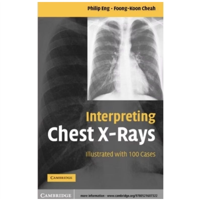 Interpreting chest x rays illustrated with 100 cases | Shopee Malaysia