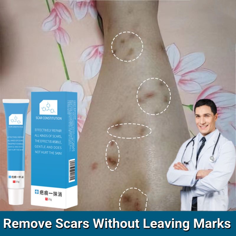 krim hilangkan parut scar repair hilang parut jerawat acne scar removal ...