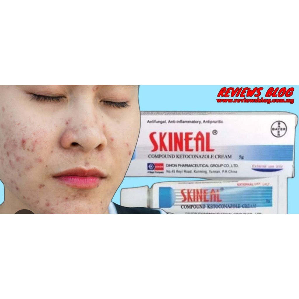 VIXA SKINEAL for face and body 15g/ditunjukkan untuk penggunaan topikal ...