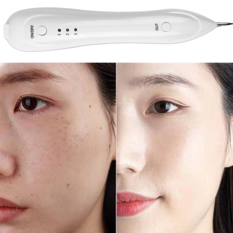 SPOT PEN Laser Penanggal Tahi lalat Kutil Jeragat ketuat bintik hitam ...