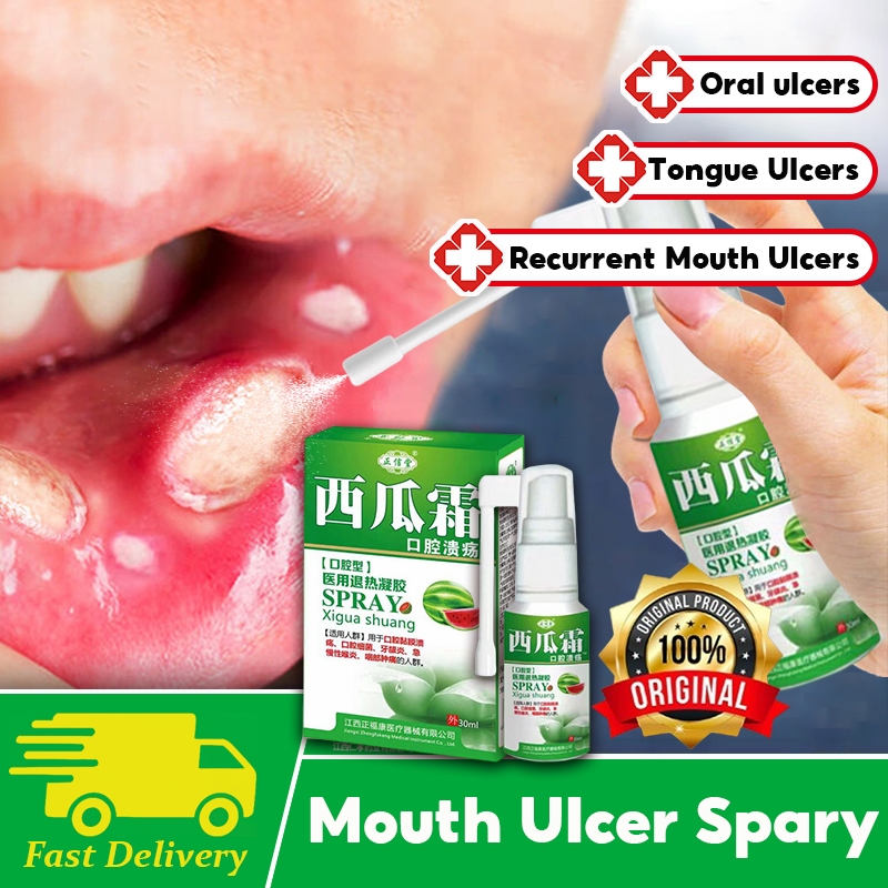 herbal mouth spray mouth ulcer spray ubat ulser mulut oral spray relief ...