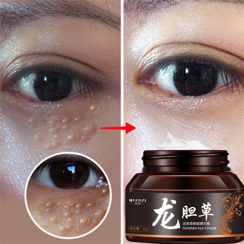 GENTIAN EYECREAM HILANGKAN BIJI KOLESTROL DI Bawah mata dan Muka, Rawat ...